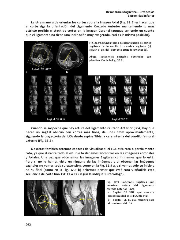 RM de Rodilla PDF | PDF | Rodilla | Anatomía humana
