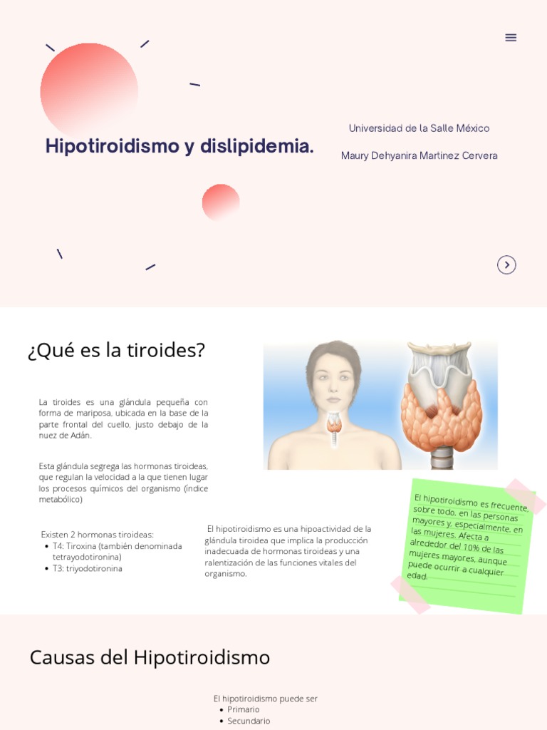Hipotiroidismo y Dislipidemia. | PDF | Tiroides | Lipoproteína