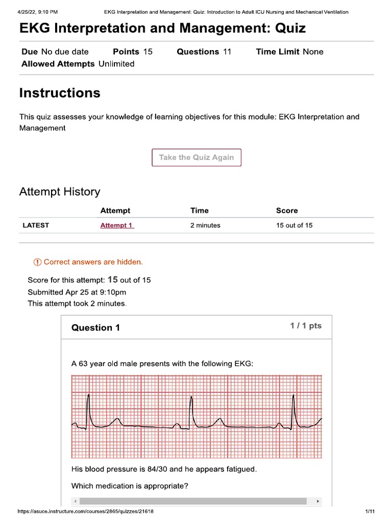 Asu Ekg | PDF