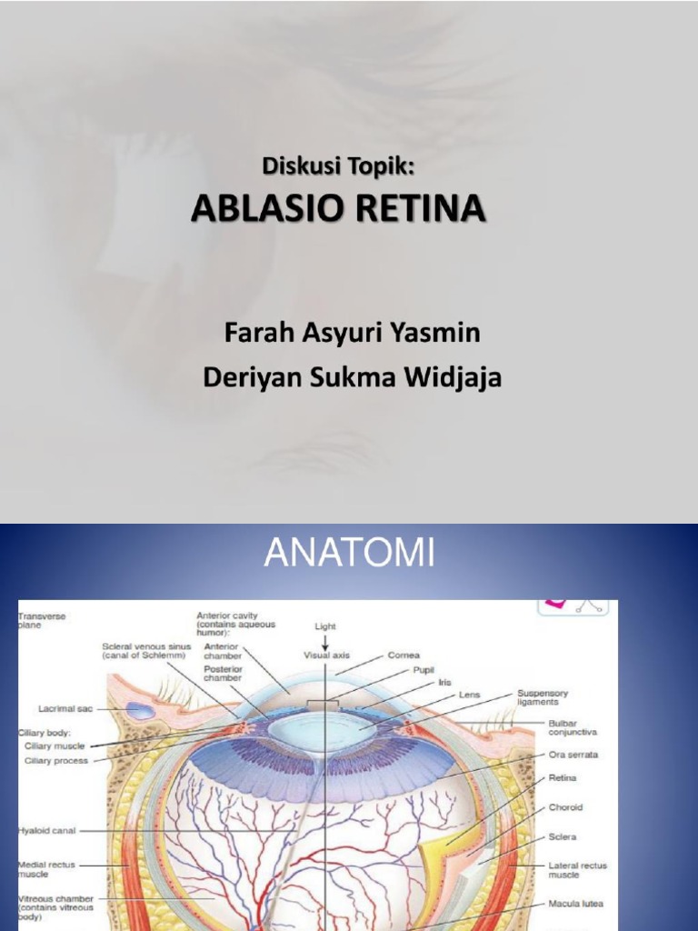 Ablasio Retina | PDF