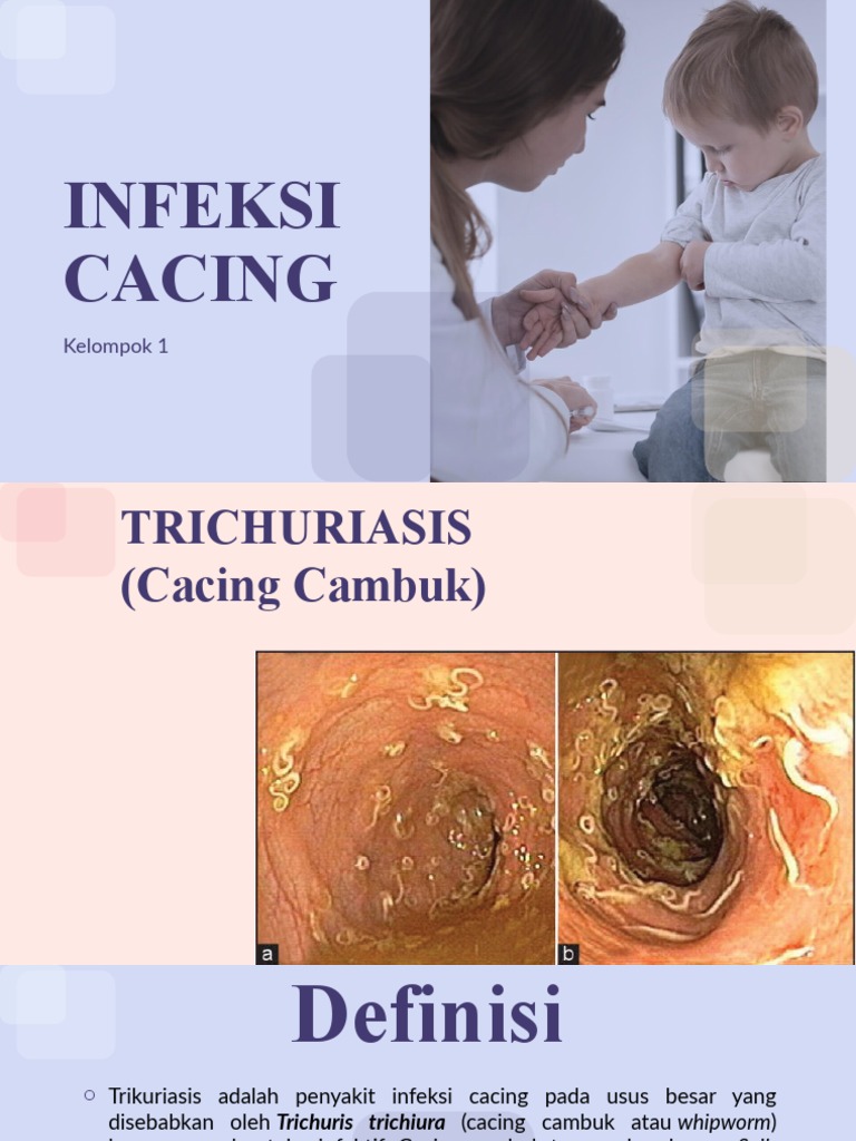 Trichuriasis Dan Oxyuriasis | PDF