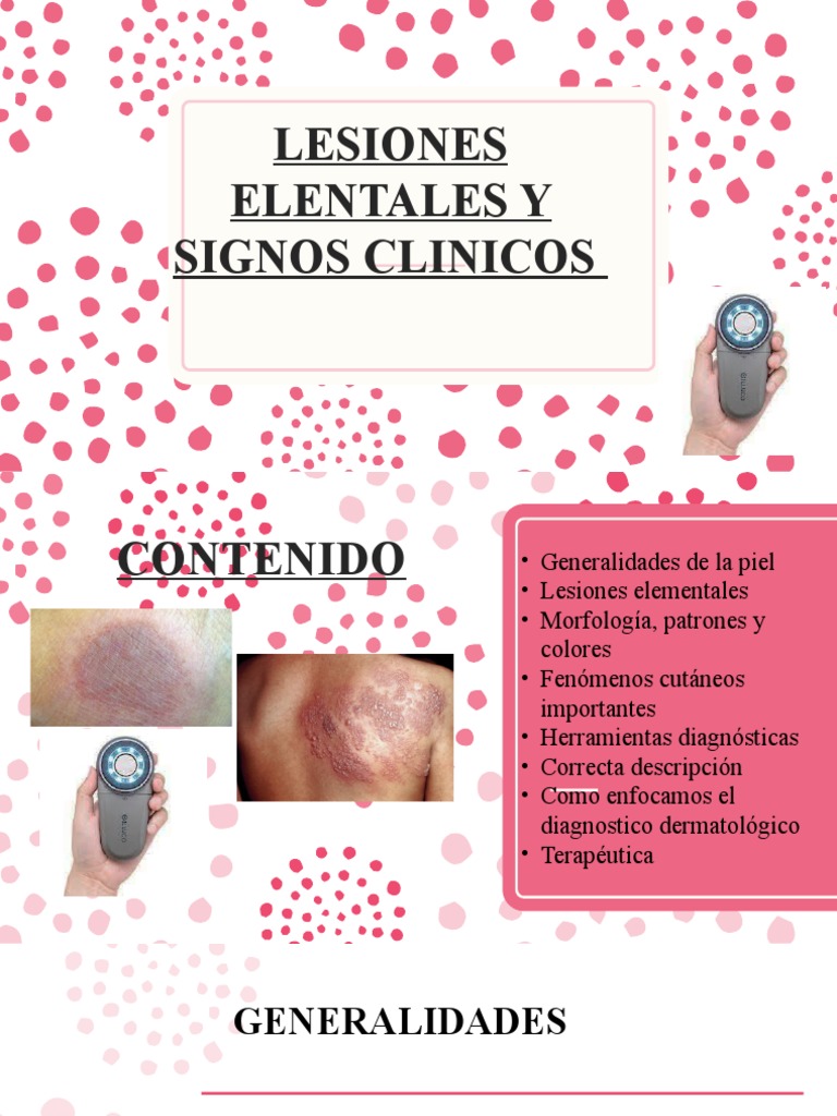 Lesiones Elementales | PDF | Piel | Dermatología