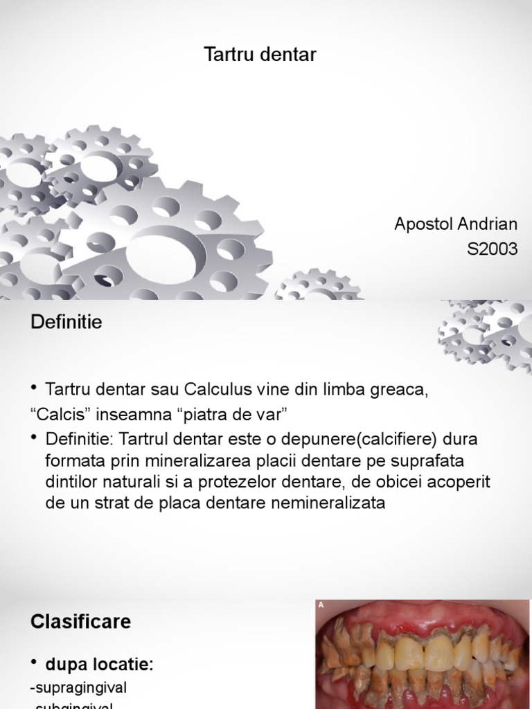 Tartru Dentar | PDF