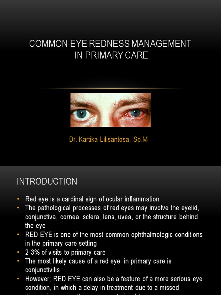 Redness Eye Treatment | PDF | Human Eye | Glaucoma