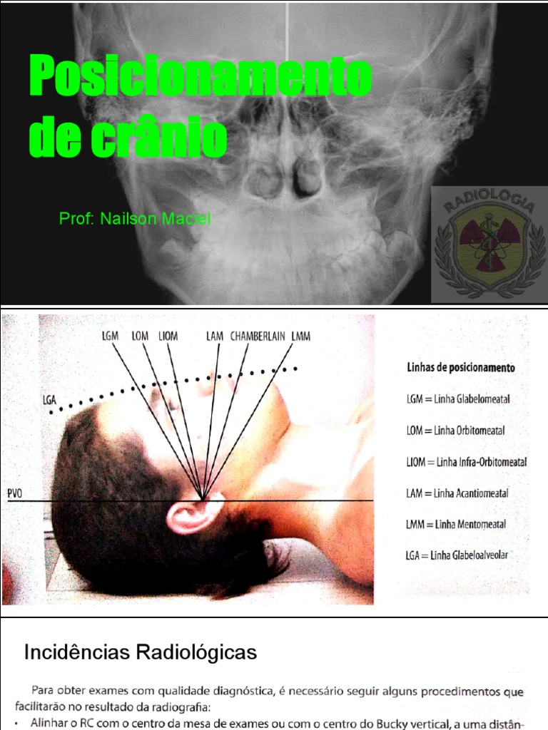 Posicionamentos radiográficos de crânio e face: descrição das ...