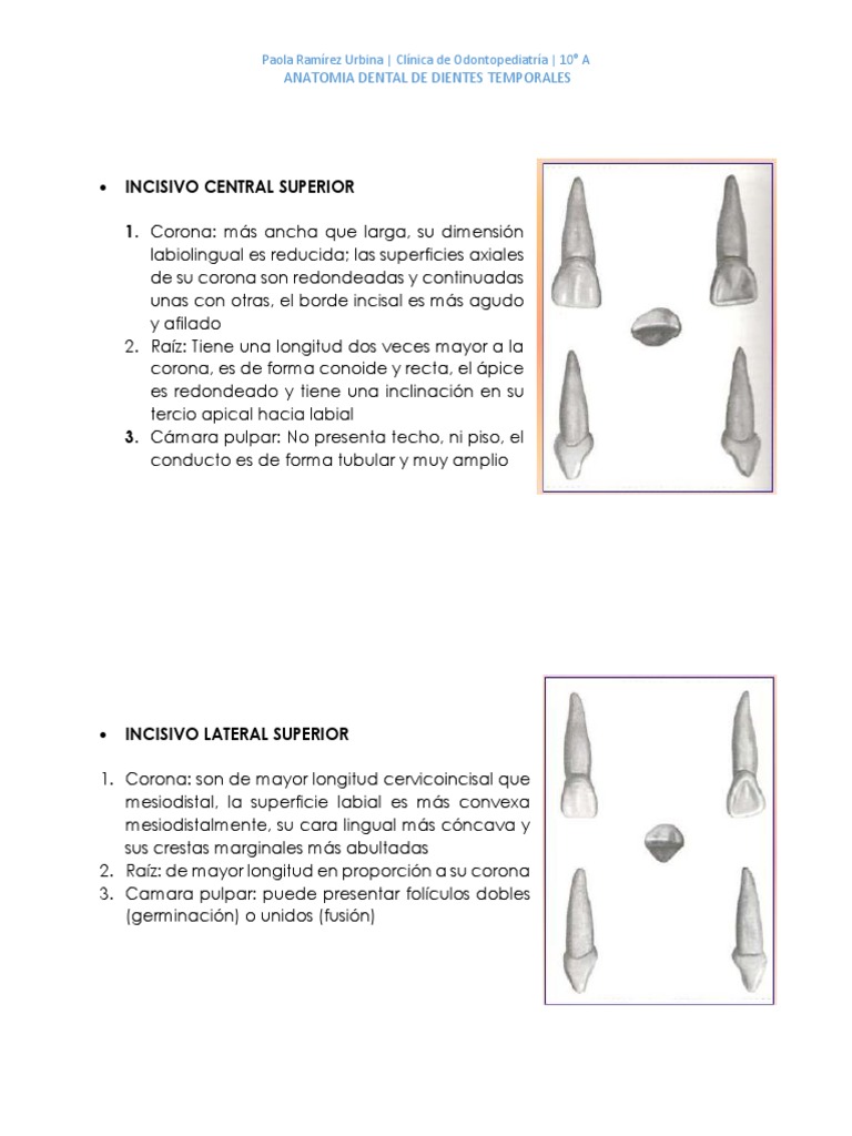 Anatomía dental de los dientes temporales: descripción de las ...