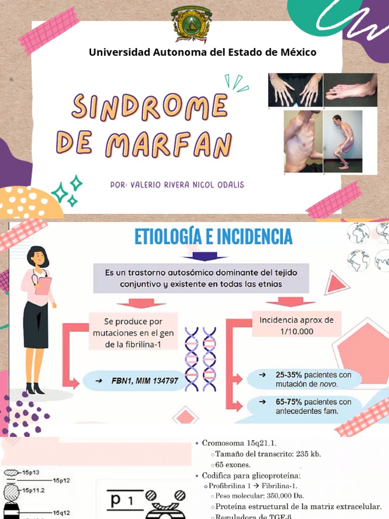 Sindrome de Marfan Presentacion | PDF