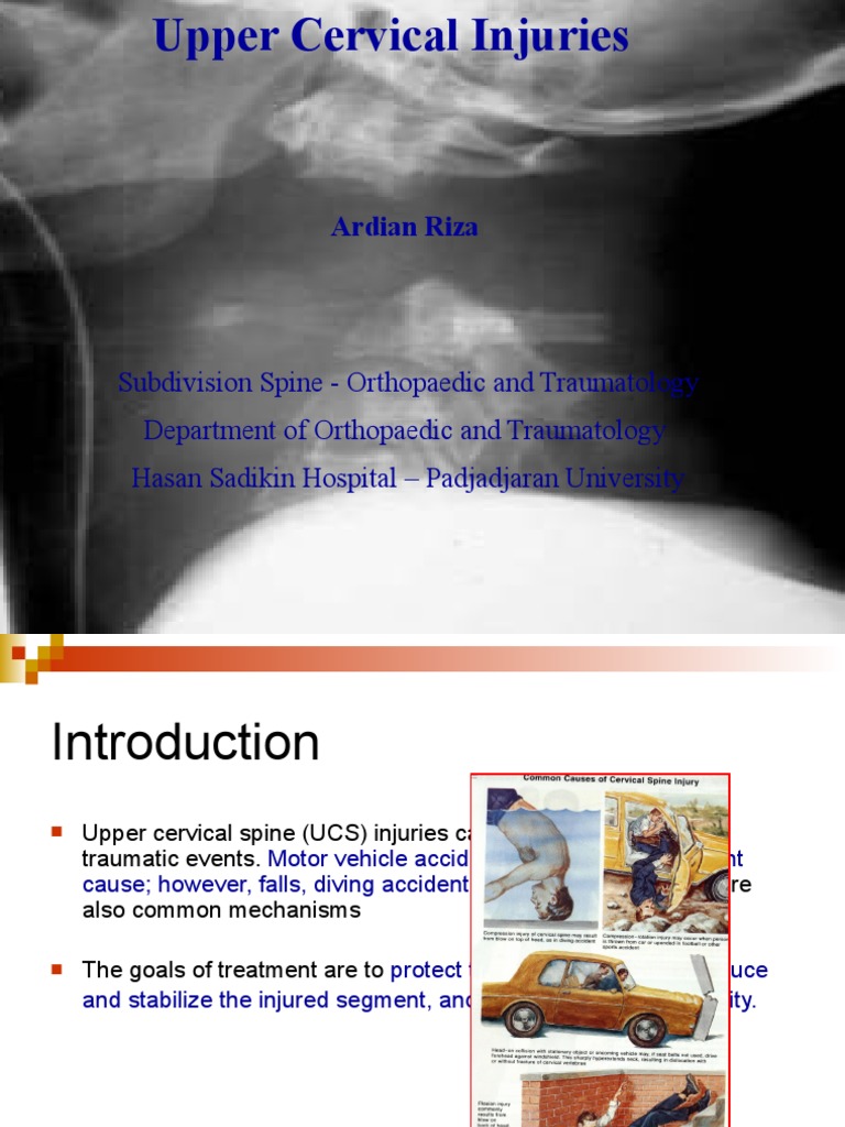 Management of Upper Cervical Spine Injuries: Evaluation, Treatment ...