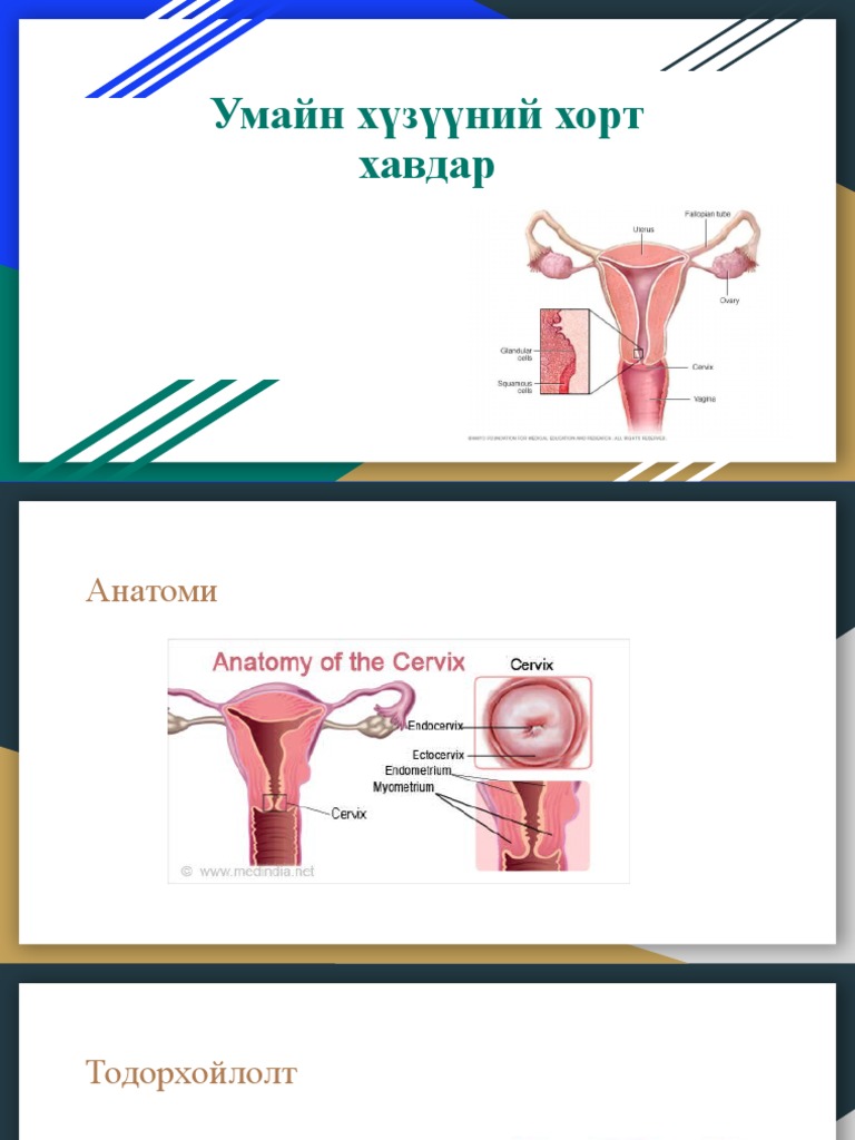 Умайн хүзүүний хорт хавдар 2 Pdf