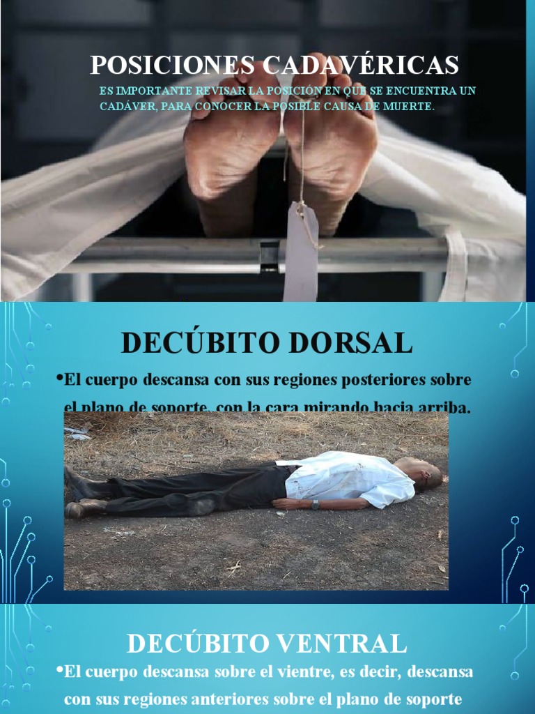 Posiciones Cadavericas | PDF