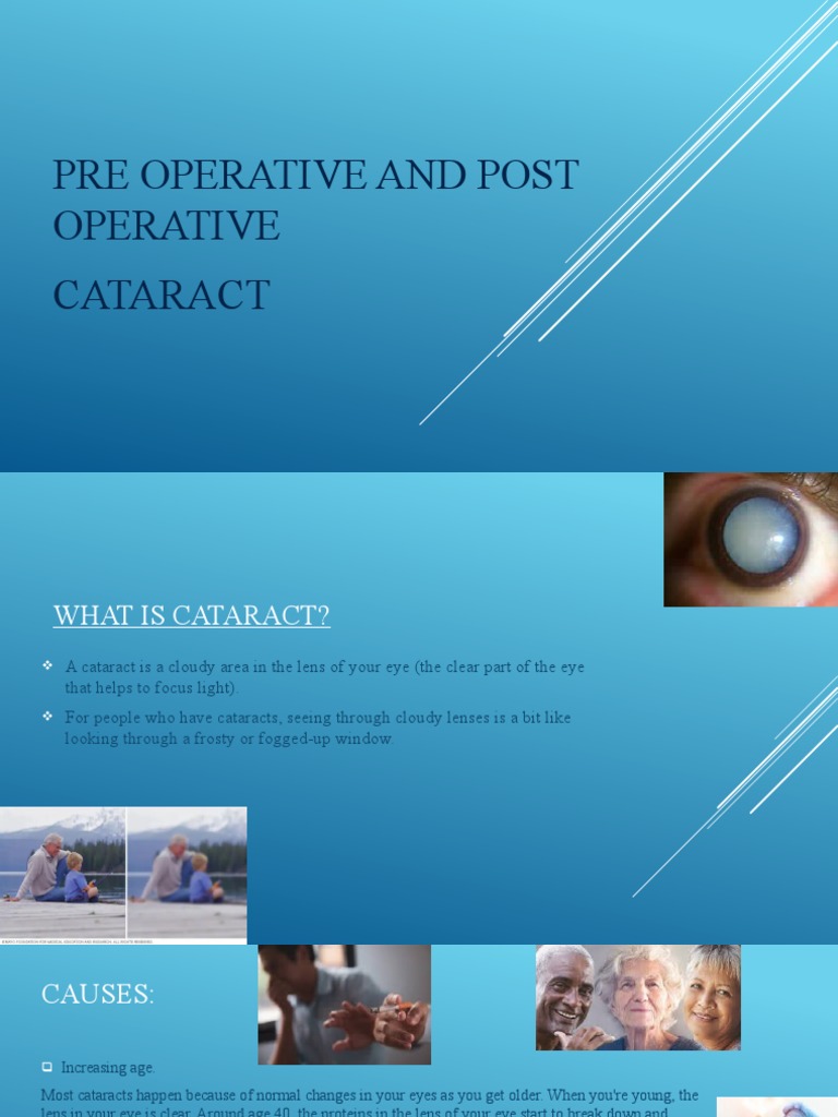 Pre-Op and Post-Op Cataracts | PDF | Cataract | Eye
