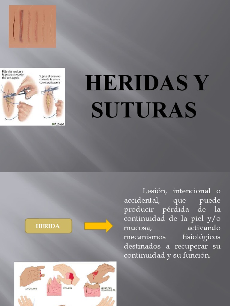 Heridas y Suturas | PDF | Herida | Piel