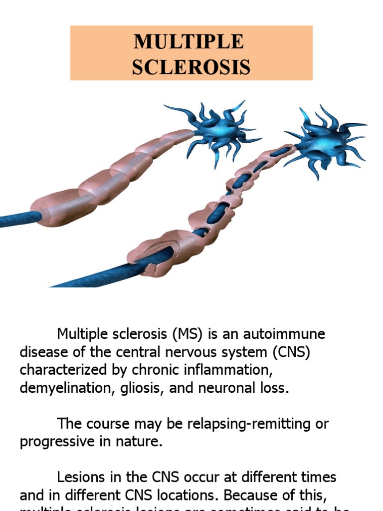 Multiple Sclerosis | PDF | Multiple Sclerosis | Neurological Disorders