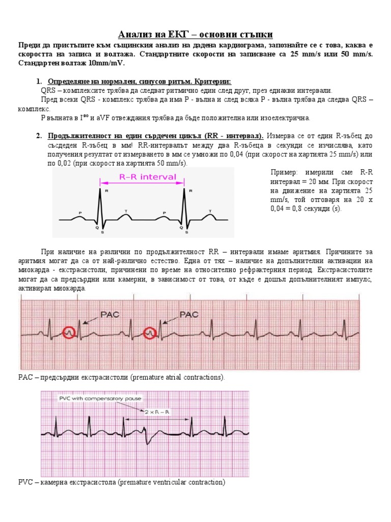 EKG Analiz BG | PDF