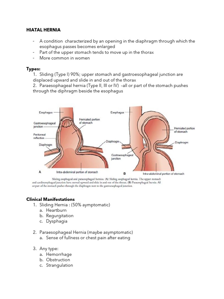 Hiatal Hernia | PDF