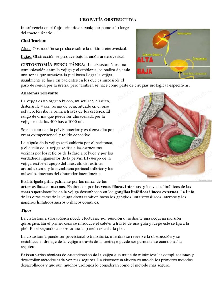 Cistostomía Percutánea: Procedimiento y Complicaciones | PDF | Vejiga ...