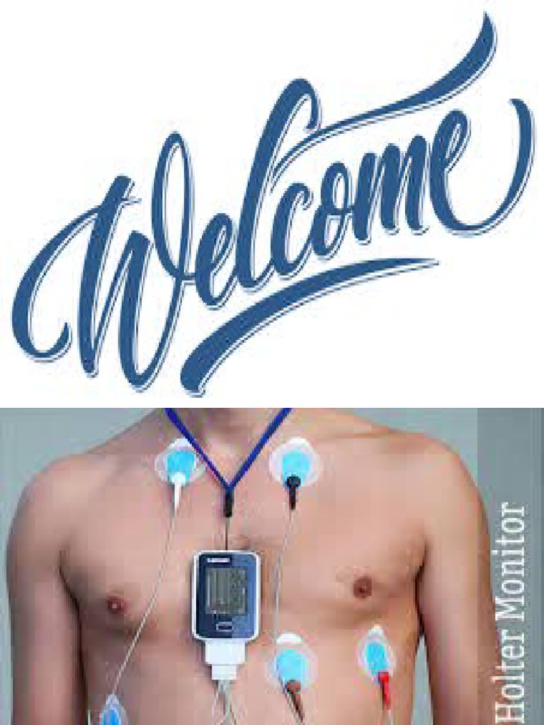 Holter Monitoring | PDF | Medicine | Cardiovascular Physiology
