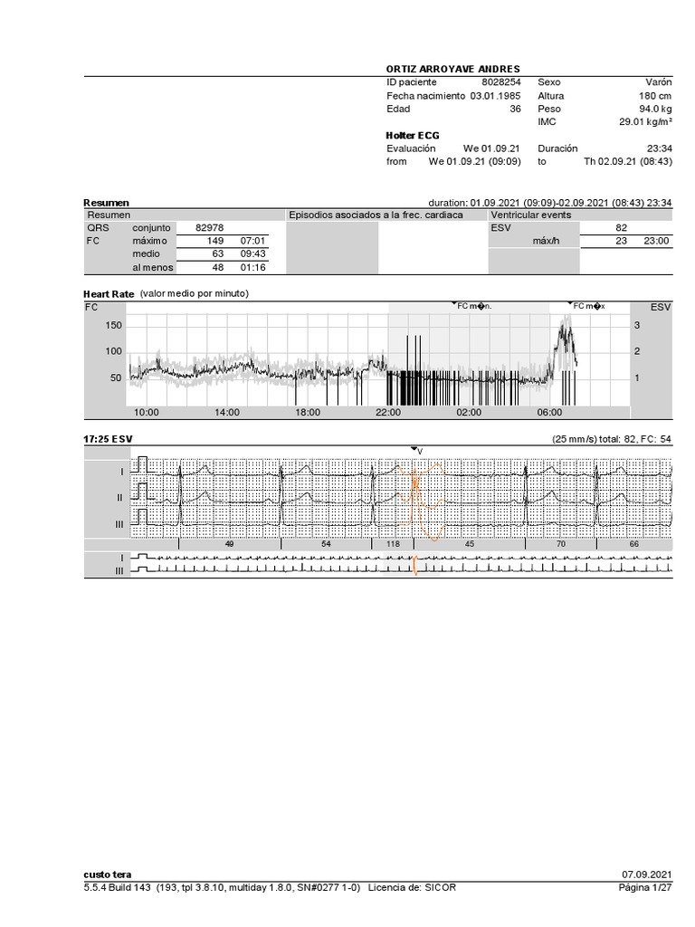 Holter | PDF | Electrocardiografia | Electrofisiología cardíaca