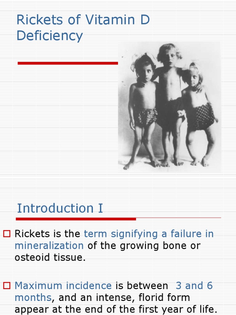 Rickets PDF | PDF | Vitamin D | Bone