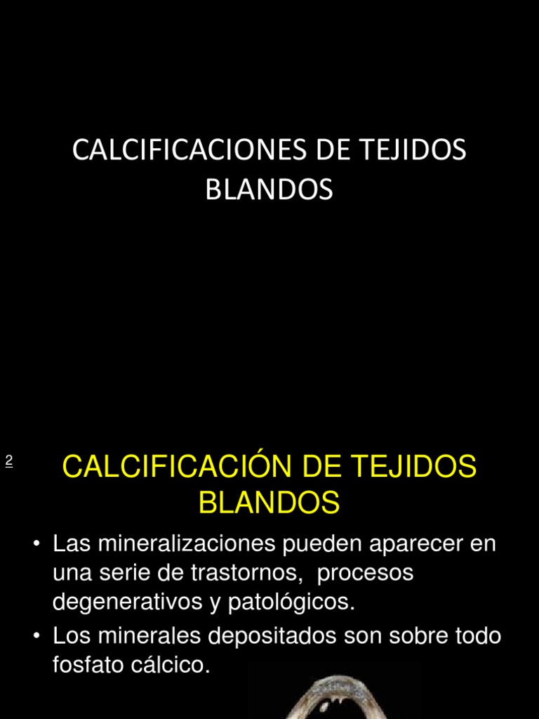 Calcificaciones en Tejidos Blandos | PDF | Especialidades Medicas ...