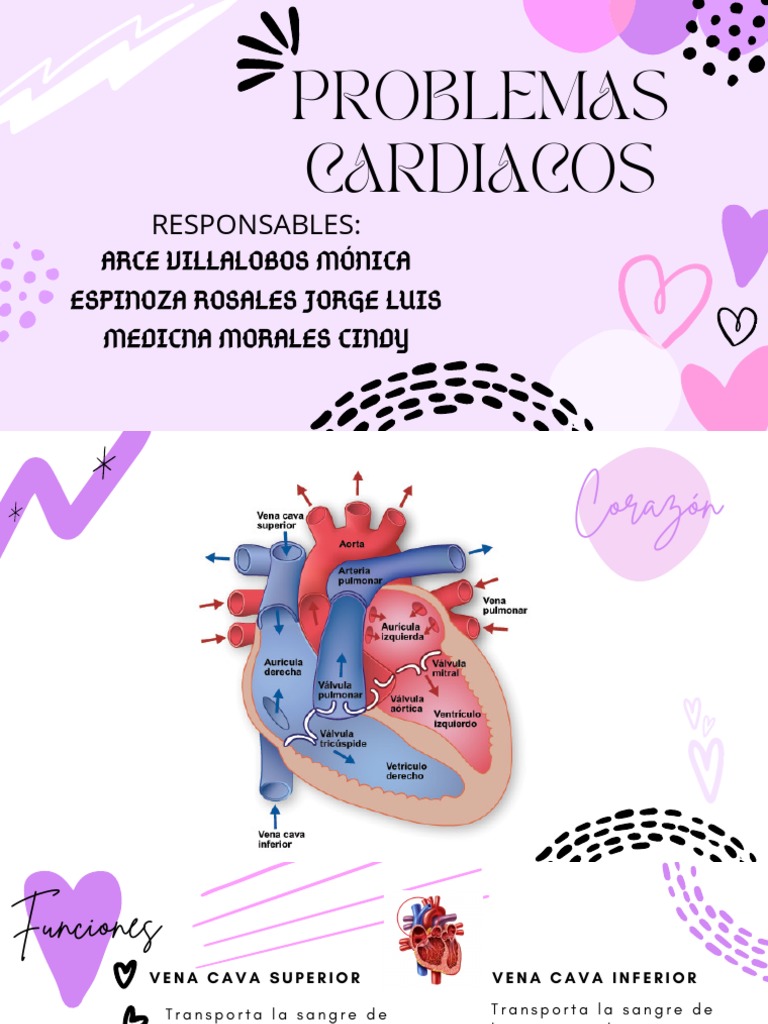 PROBLEMAS CARDIACOS | PDF | Infarto de miocardio | Ventrículo (corazón)