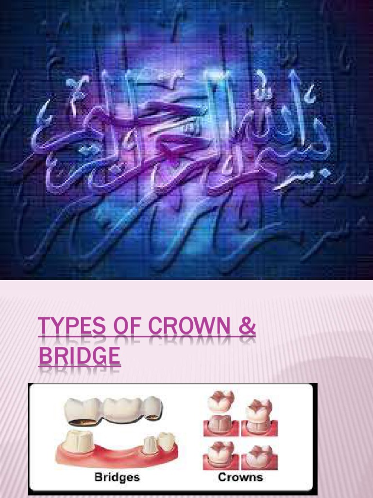 Types of Crowns and Bridges | PDF | Dentistry Branches | Dentistry