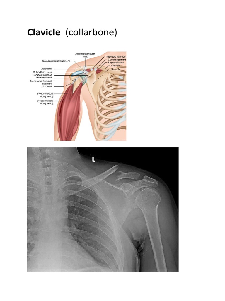 Bones Notes Mbbs | PDF | First Aid | Injury