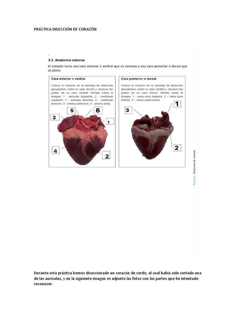 Práctica Disección de Corazón | Descargar gratis PDF | Ventrículo ...