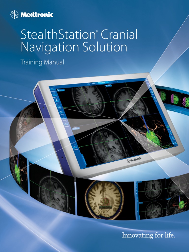 StealthStation Synergy Cranial Training Manual PDF | PDF | Camera ...