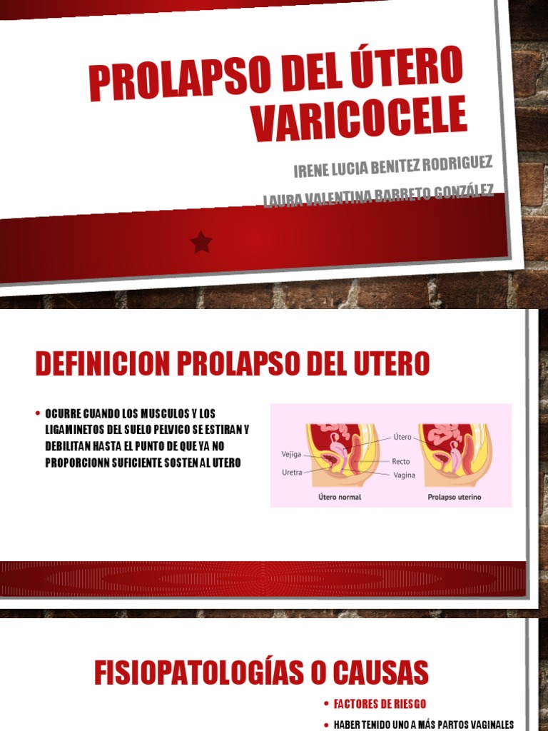 Prolapso Del Útero | PDF | Anatomia sexual | Causas de la muerte