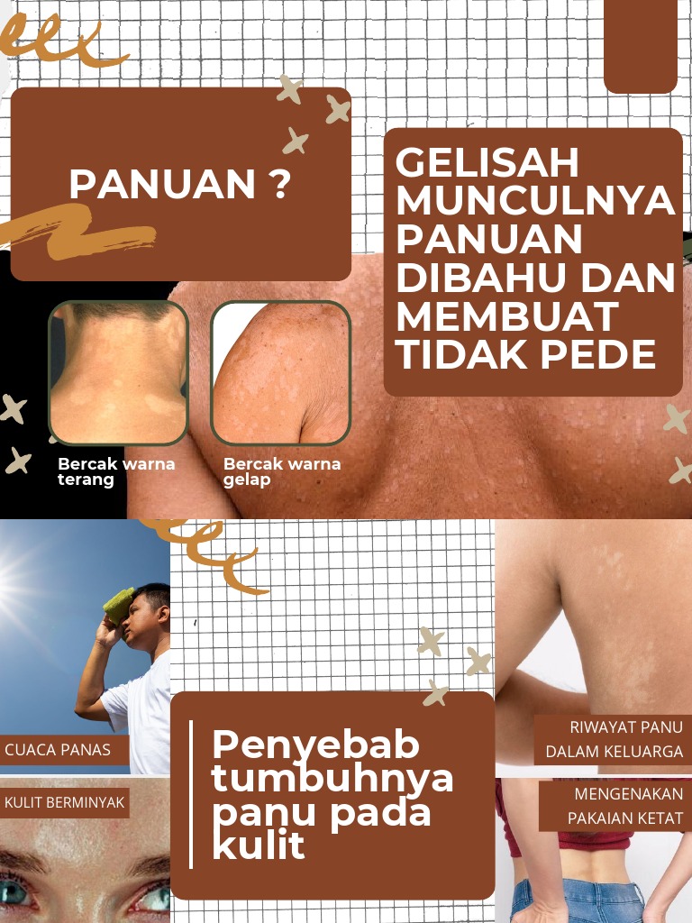 Contoh Landing Page Obat Panu | PDF