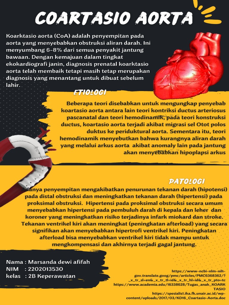 Coartasio Aorta | PDF