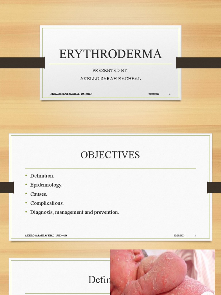 Understanding Erythroderma: Causes & Treatment | PDF | Dermatitis ...