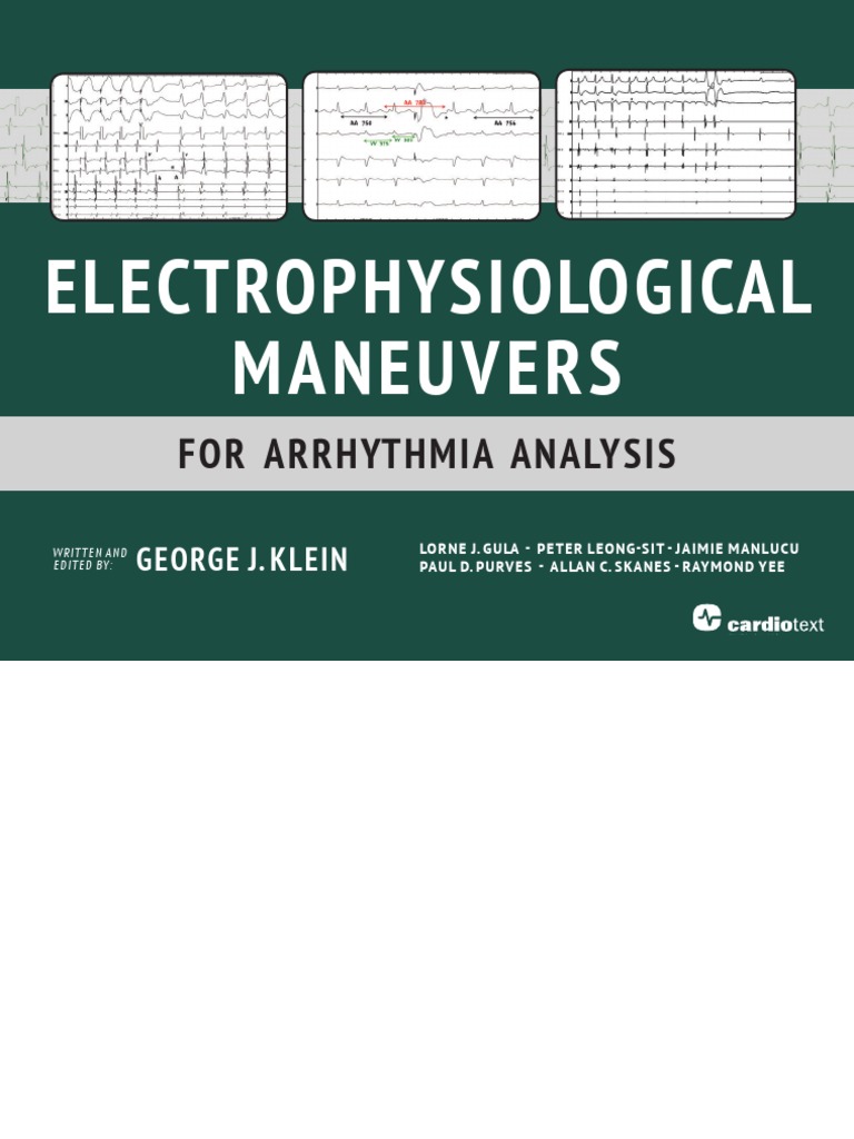 Electrophysiological Maneuvers For Arrhythmia Analysis-Cardiotext ...