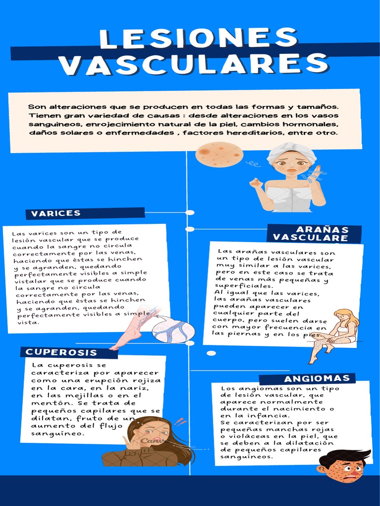 Lesiones PDF | PDF | Venas varicosas | Anatomía