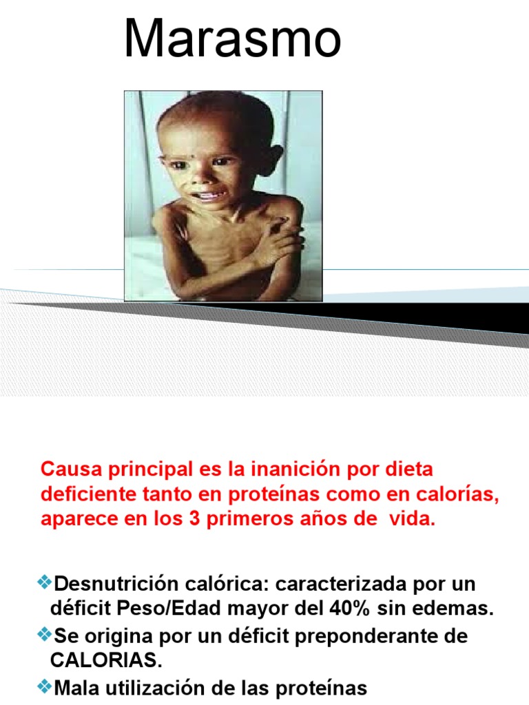 3 Marasmo | PDF | Nutrición | Dieta y nutrición