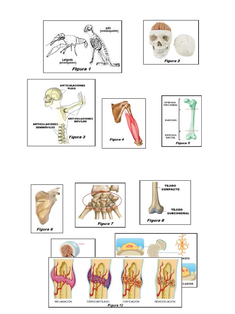 Graficos Del Estudio General de Los Huesos | PDF