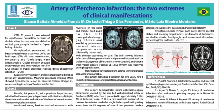 Artery of Percheron Infarction: The Two Extremes of Clinical ...