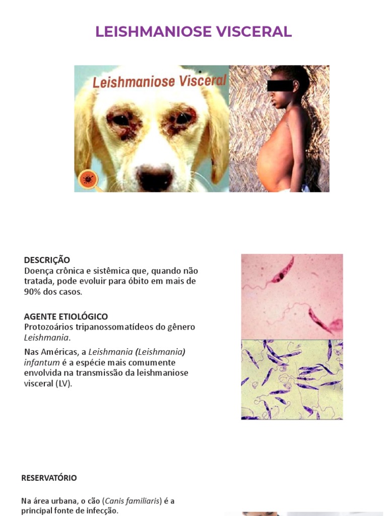 LEISHMANIOSE VISCERAL | PDF | Epidemiologia | Microbiologia LEISHMANIOSE VISCERAL | PDF | Epidemiologia | Microbiologia