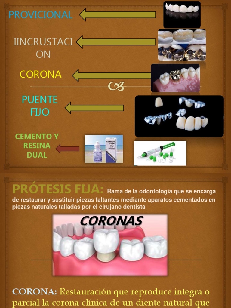Coronas PDF | Descargar gratis PDF | Dentadura postiza | Ramas de ...