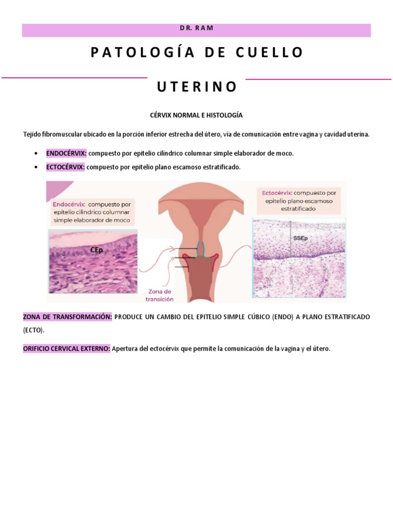 Patología (Displasia) de Cuello Uterino | PDF | Cáncer de cuello uterino | Cáncer
