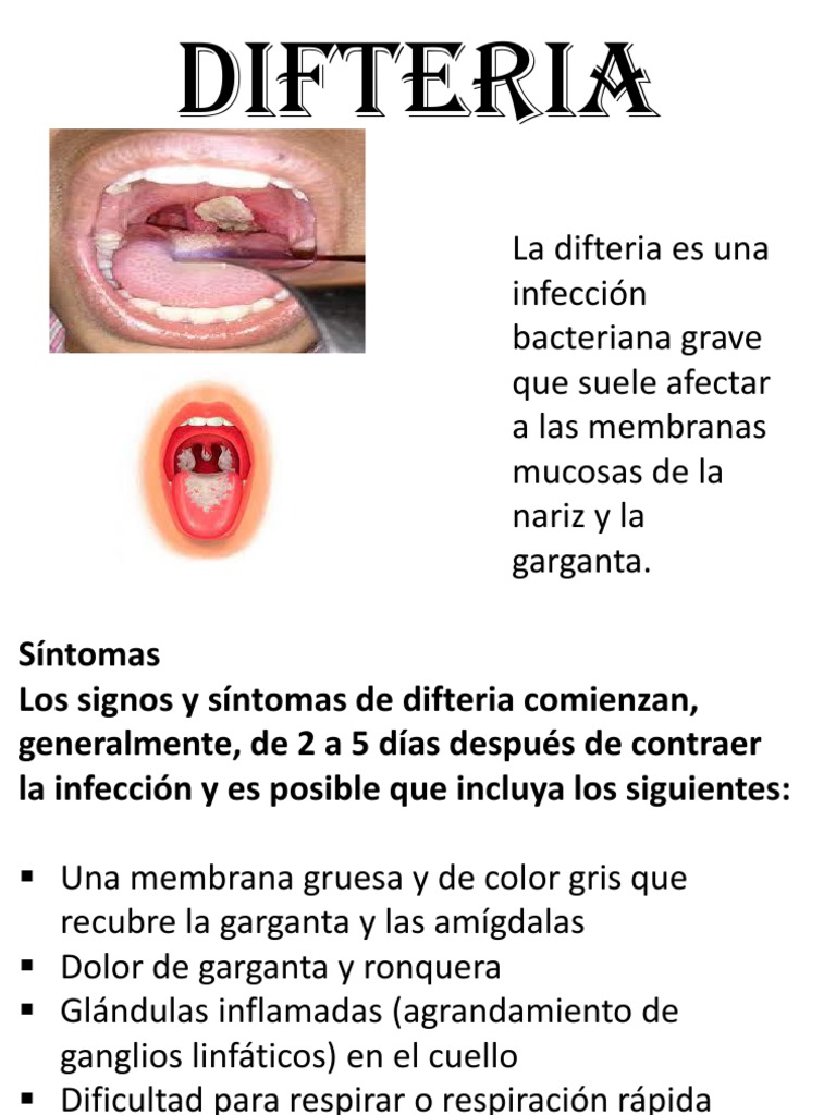Difteria | PDF | Medicina | Pediatría