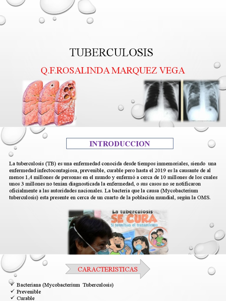 Información esencial sobre tuberculosis | PDF | Tuberculosis | Inmunología