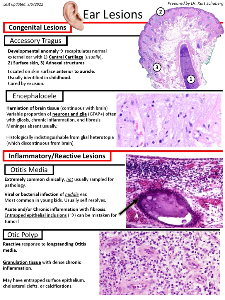 Ear Lesions | PDF | Epithelium | Diseases And Disorders