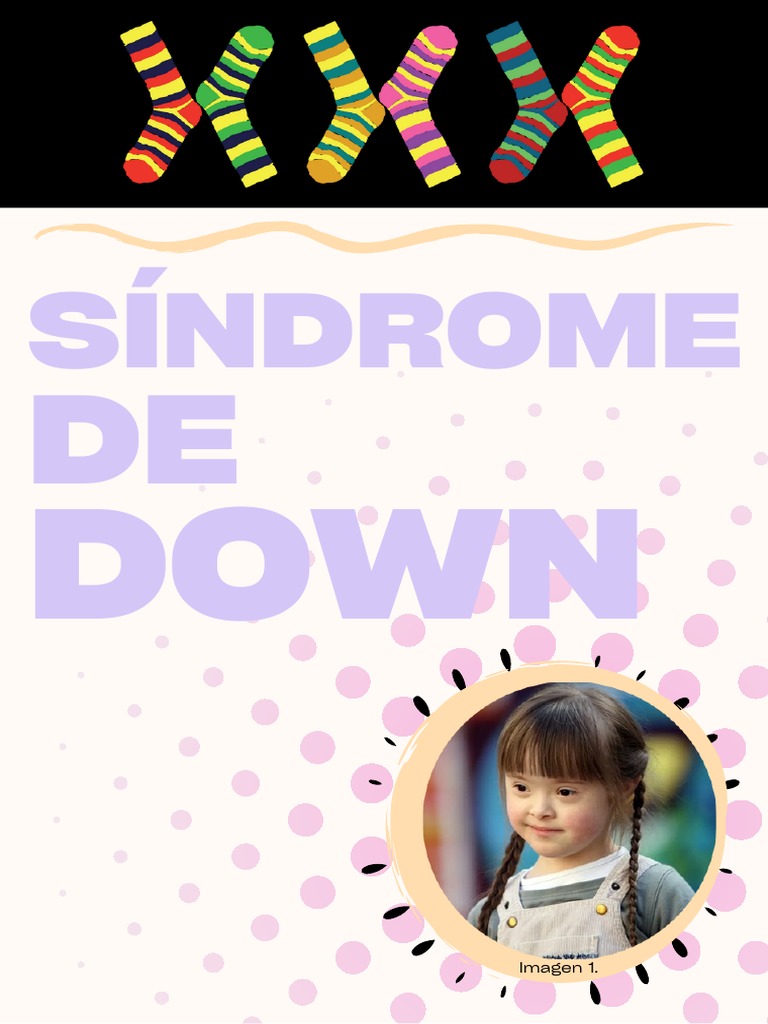 Cartilla - Síndrome de Down | PDF | Síndrome de Down | Memoria