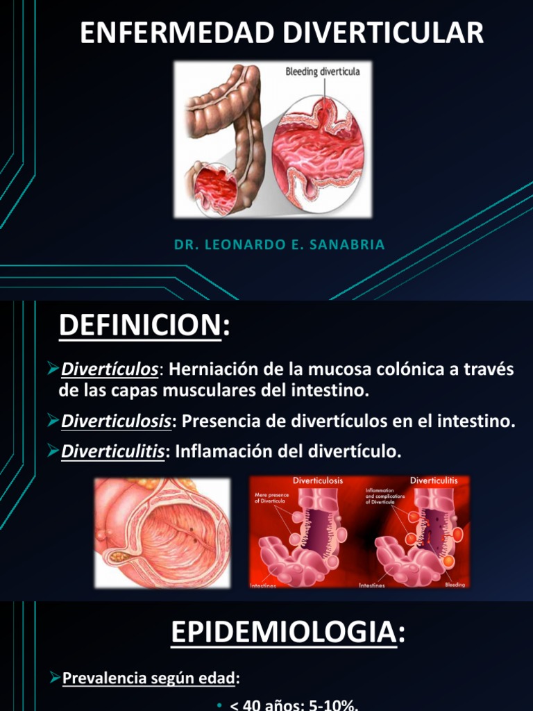 Enfermedad Diverticular | PDF | Cáncer colonrectal | Especialidades Medicas