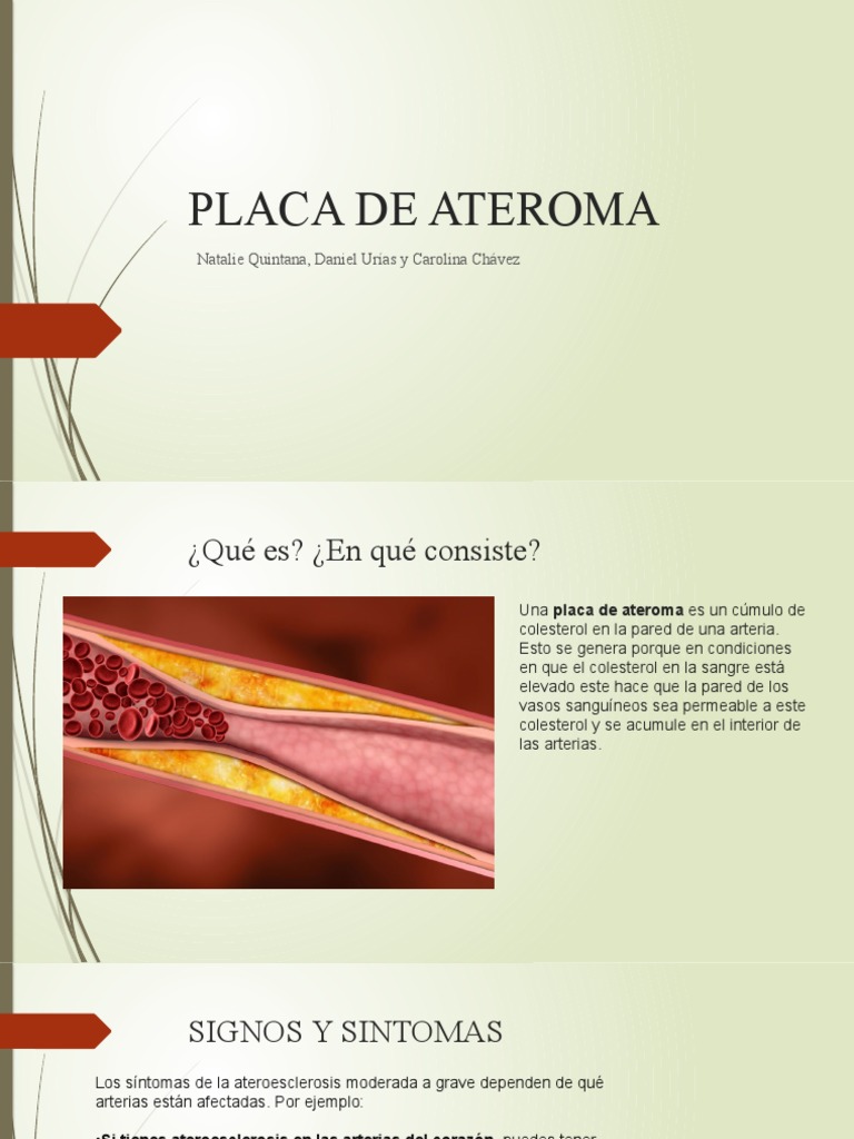 Placa de Ateroma | PDF