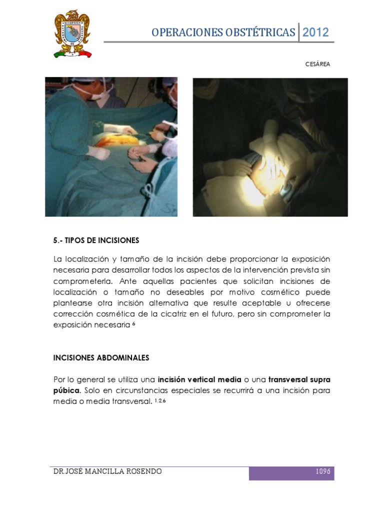 Incisiones Abdominales | PDF | Abdomen | Seccion de cesárea
