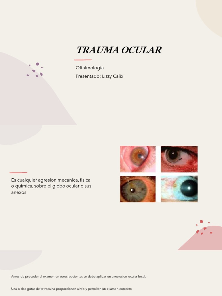 Trauma Ocular. | PDF | Ojo humano | Herida