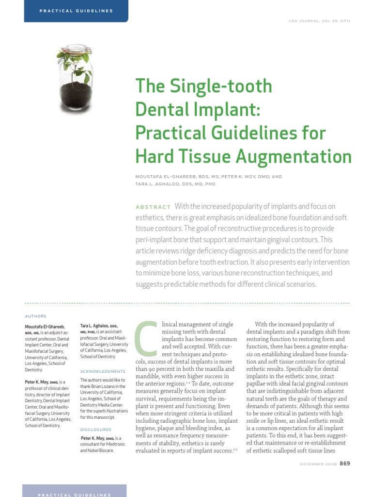 The Single-Tooth Dental Implant: Practical Guidelines For Hard Tissue ...